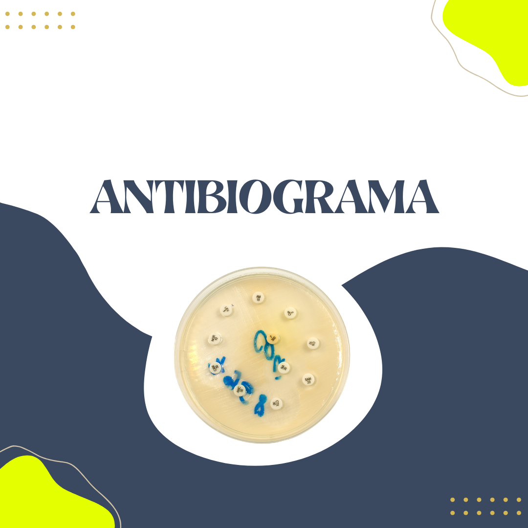 Como é feito o antibiograma? - Cursau Educação - Blog