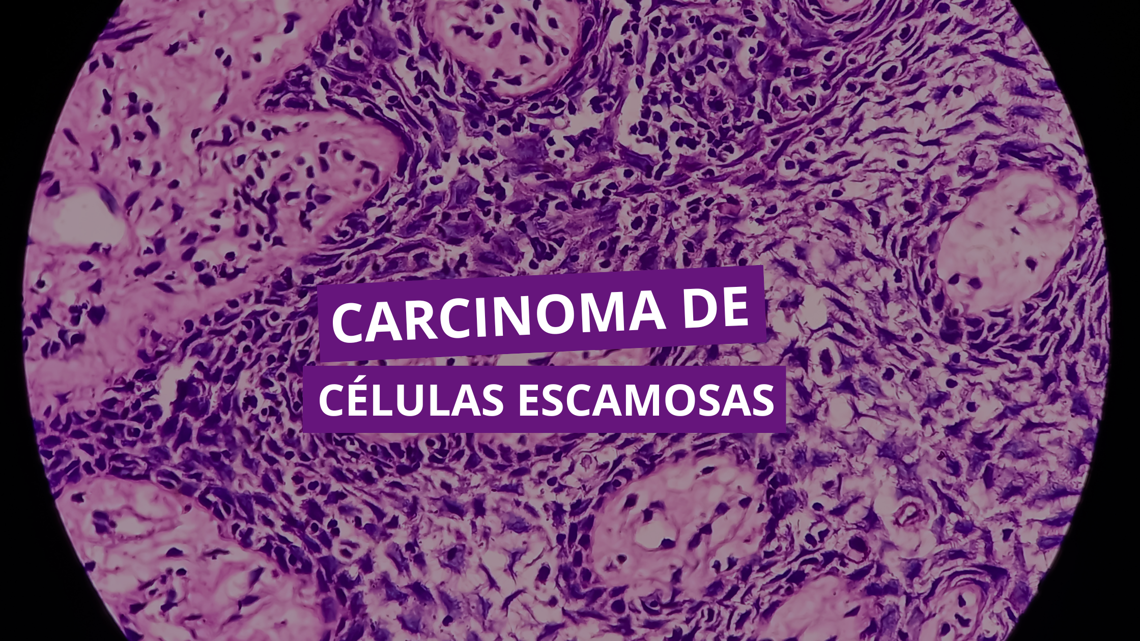 Histologia Da Orofaringe Función De La Faringe Como Funciona Que