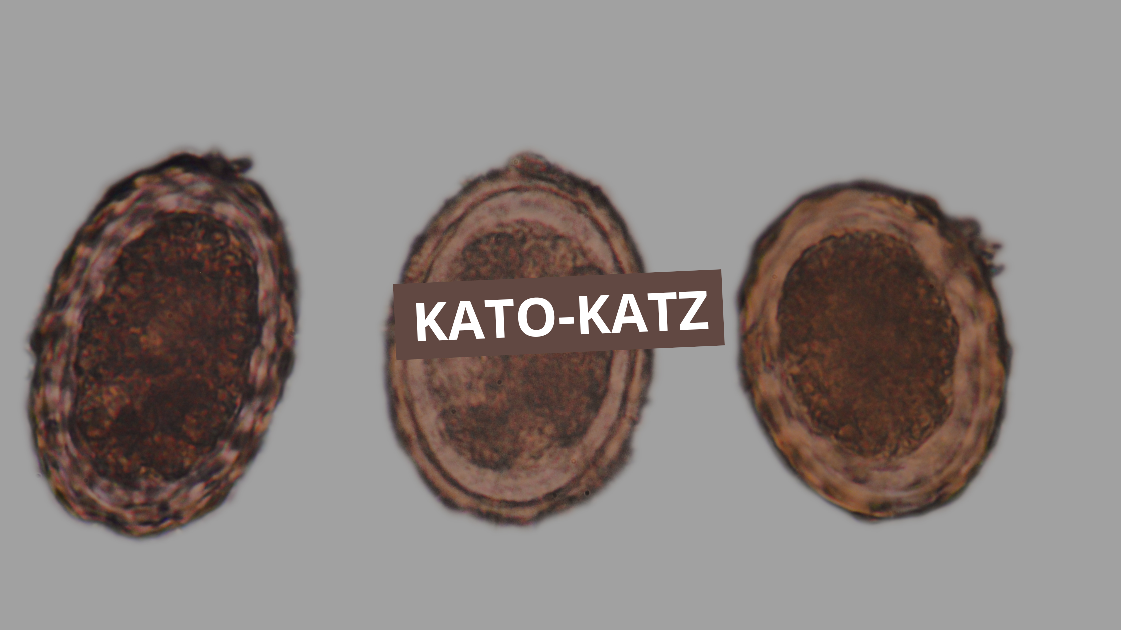 Método de Kato-Katz